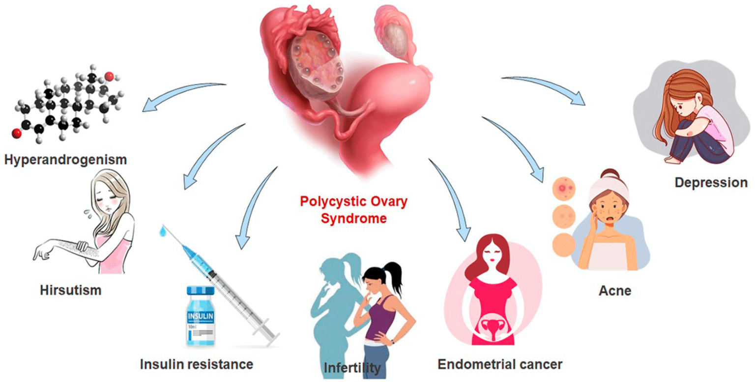 PCOD vs PCOS: Understanding the Causes, Symptoms, Key Differences, and ...